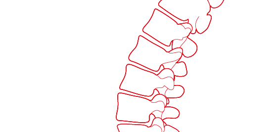 Peripheral nerve denervation with radiofrequency