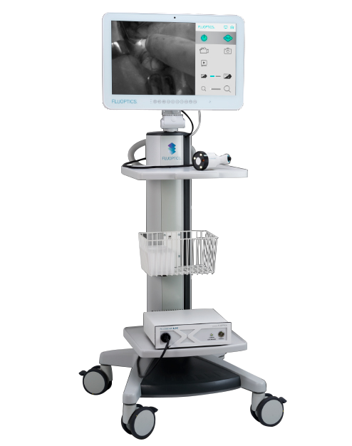 FLUOBEAM® LX: Autofluorescence in thyroid and parathyroid surgery