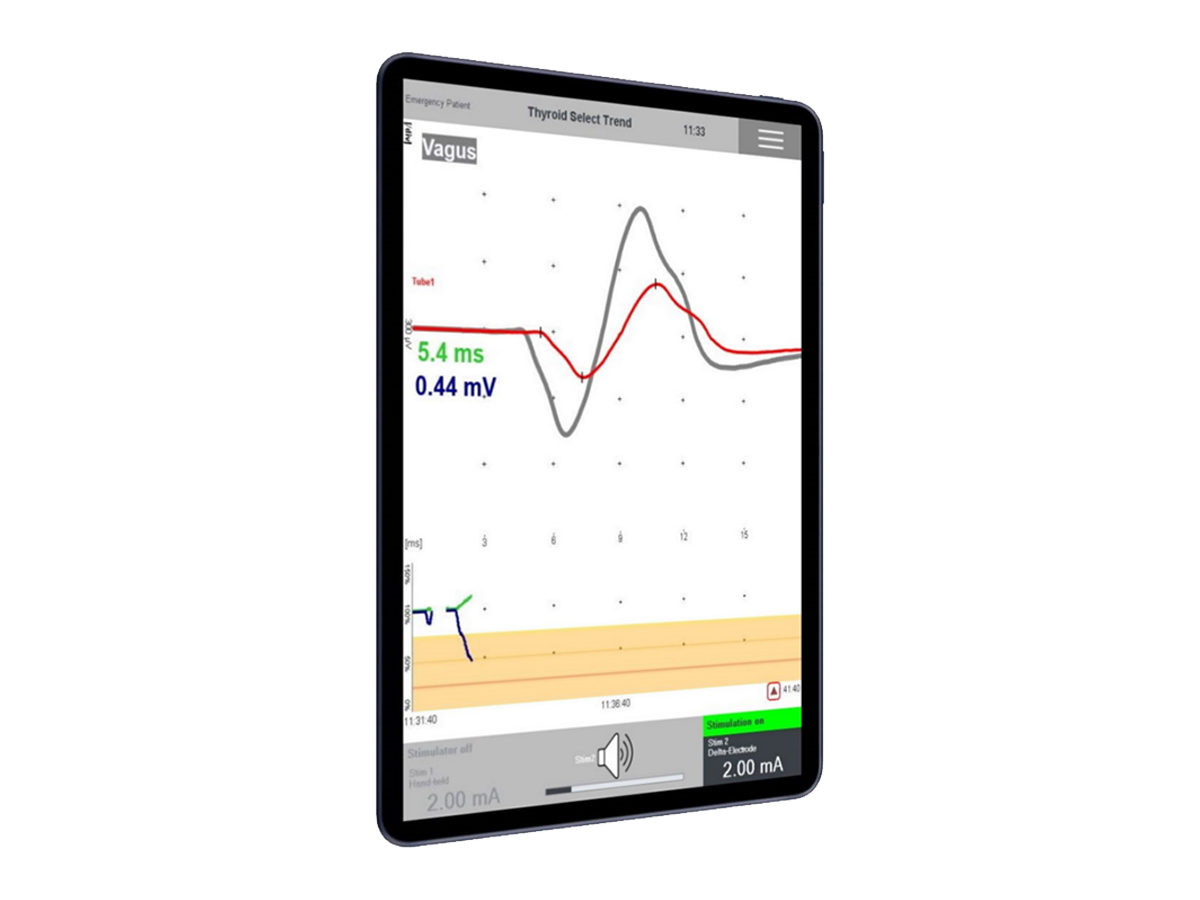C2 Xplore: One step ahead in IONM