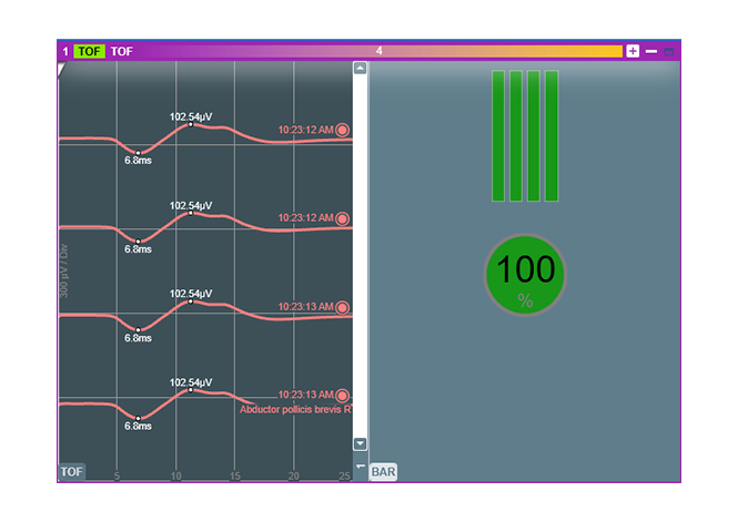 ISIS IOM family: Systems for neurophysiological monitoring