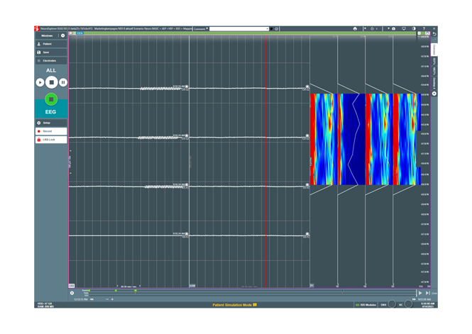 ISIS Xpert: Neurophysiological monitoring system