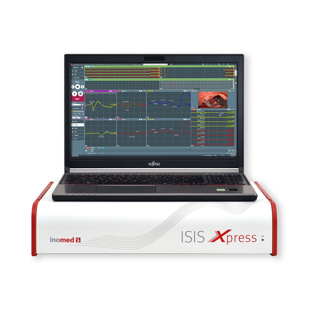 ISIS IOM family: Systems for neurophysiological monitoring