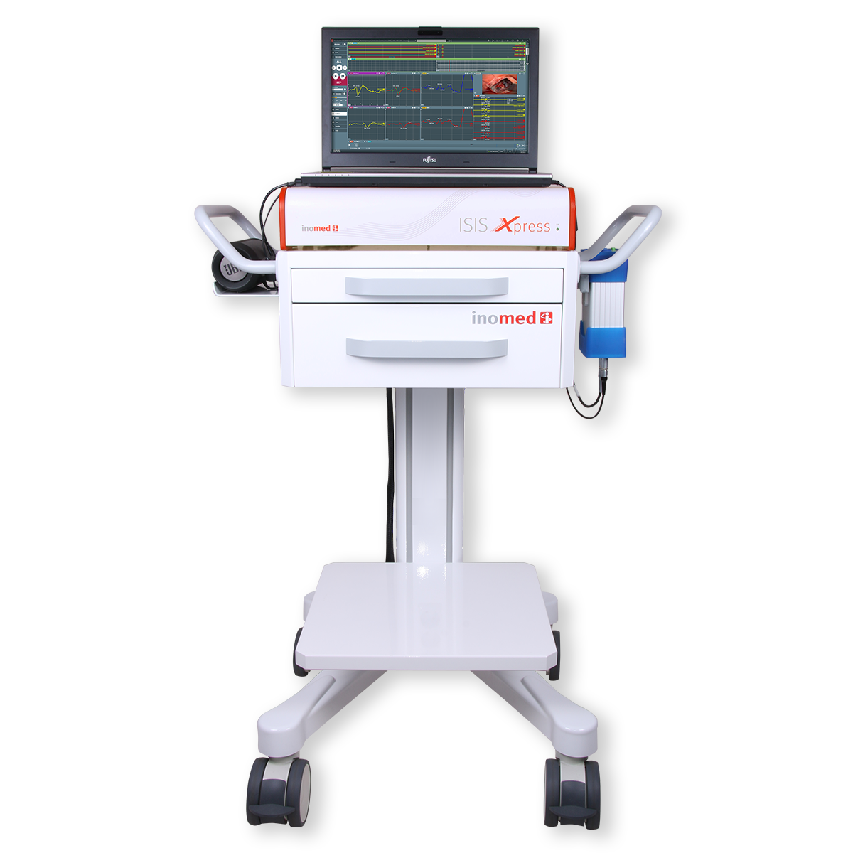 ISIS Xpress: portable neurophysiological monitoring device