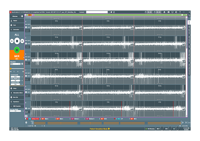 ISIS IOM family: Systems for neurophysiological monitoring