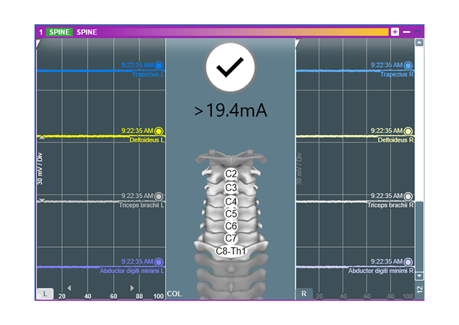 ISIS IOM family: Systems for neurophysiological monitoring