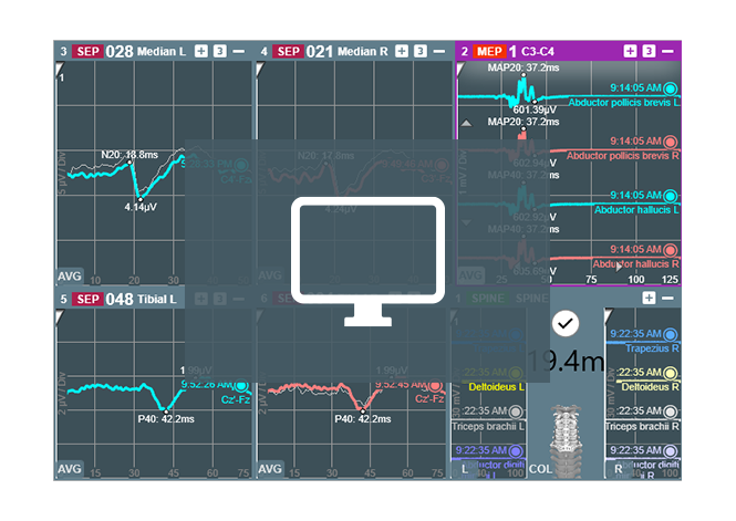 ISIS IOM family: Systems for neurophysiological monitoring