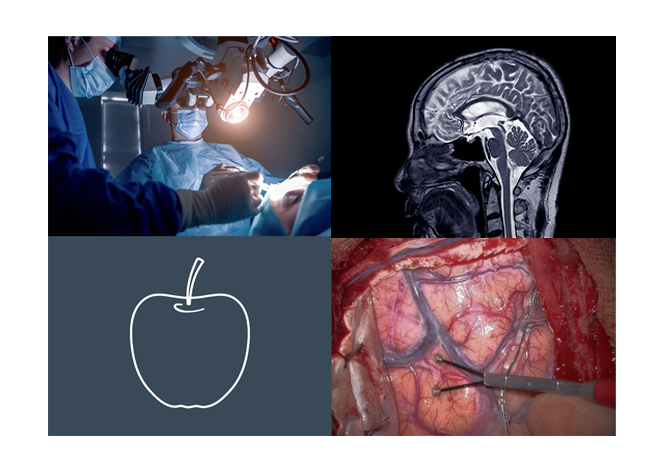 ISIS IOM family: Systems for neurophysiological monitoring