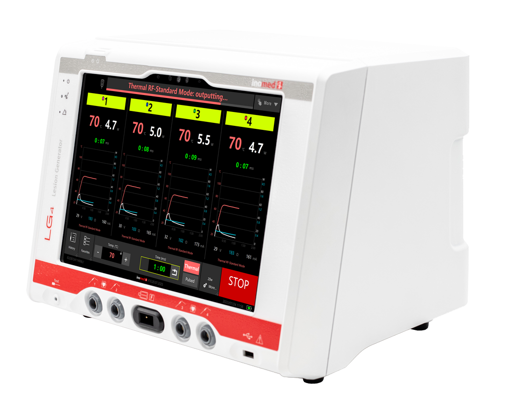 Thermocoagulation with the LG lesion generators