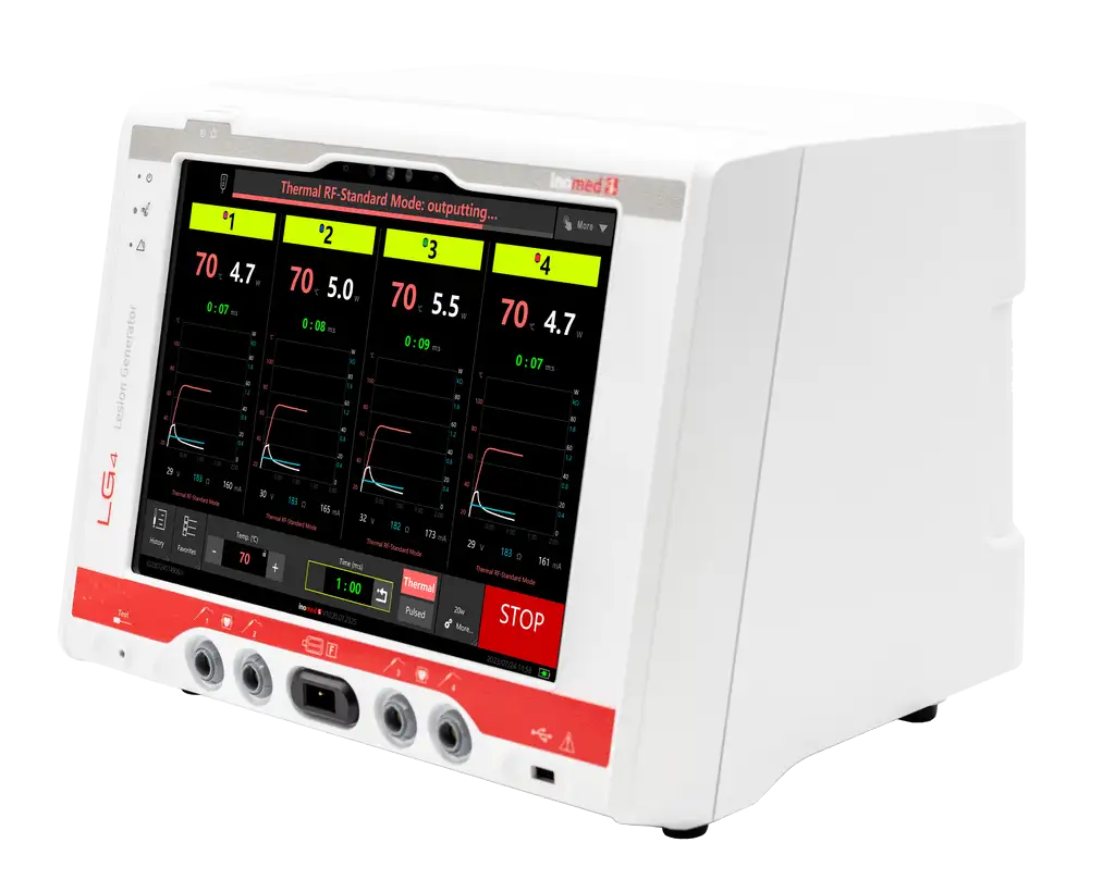 radio frequency denervation